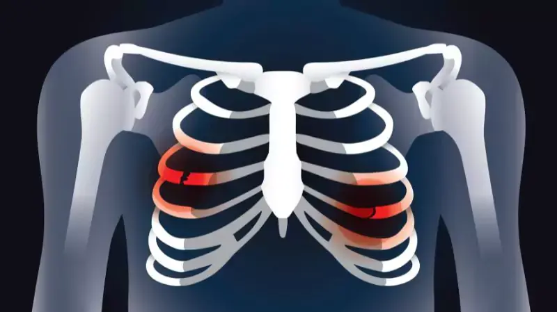 Pain Under Right Rib Cage