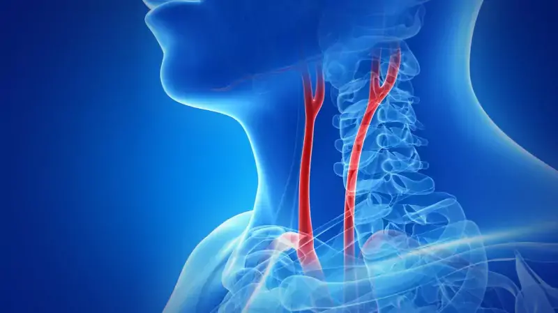 Jugular Vein Distention