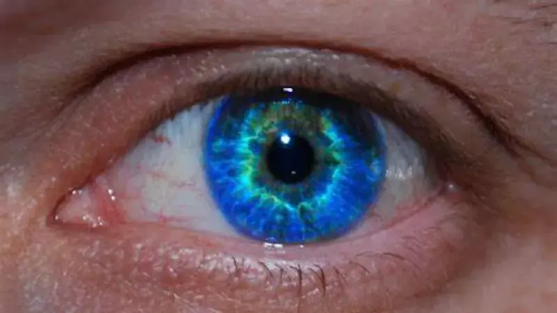 Dilated Pupils
