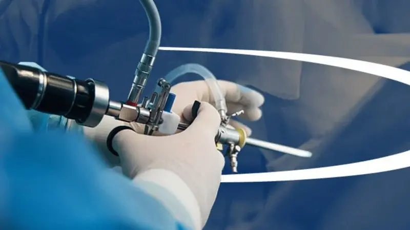 Endoscopic minimally invasive surgery using a thin tube with a camera