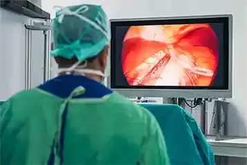 hernia-laparoscopic-surgery-for-quick-recovery_image