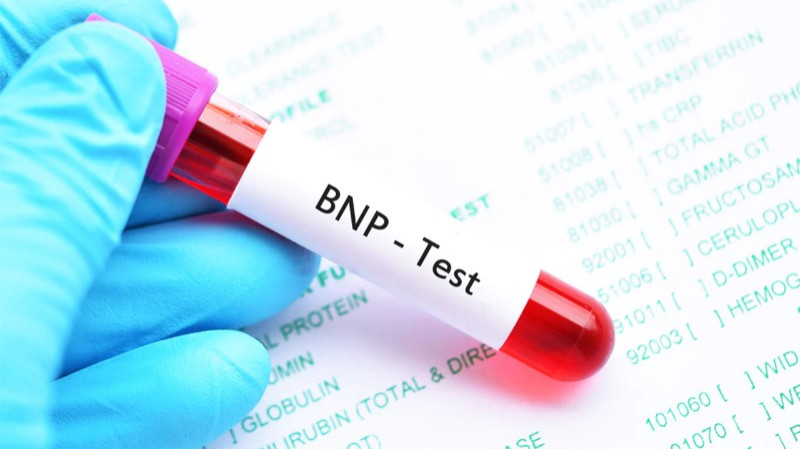 BNP Test