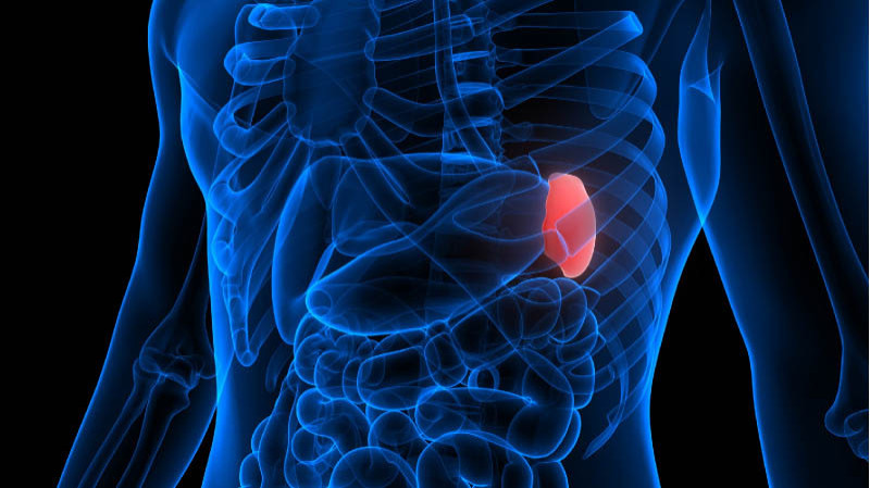 Enlarged Spleen
