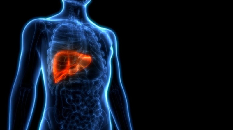 Grade 2 Fatty Liver