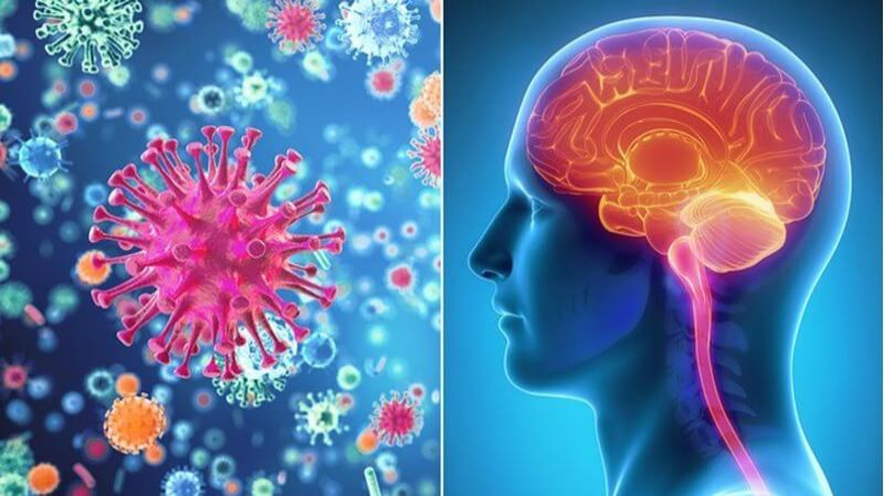 Meningitis