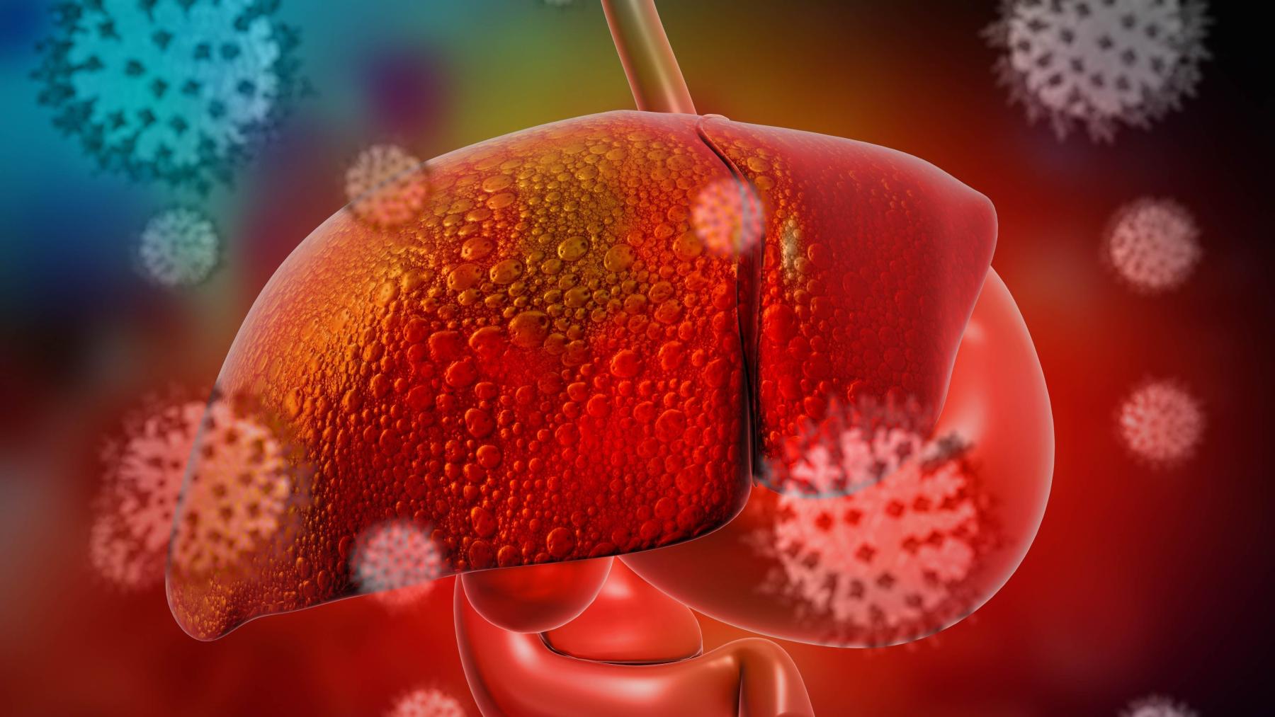 Causes of Acute Liver Failure